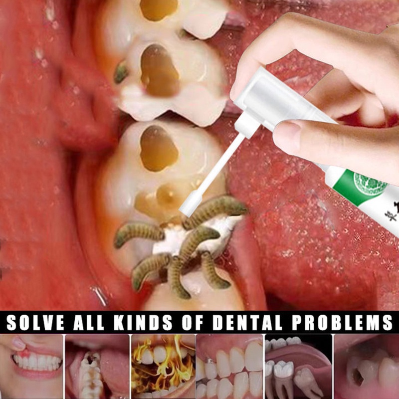 HoubIIOR Tooth Pain Relief Treatment Spray Toothache Cure Teeth Decay ...