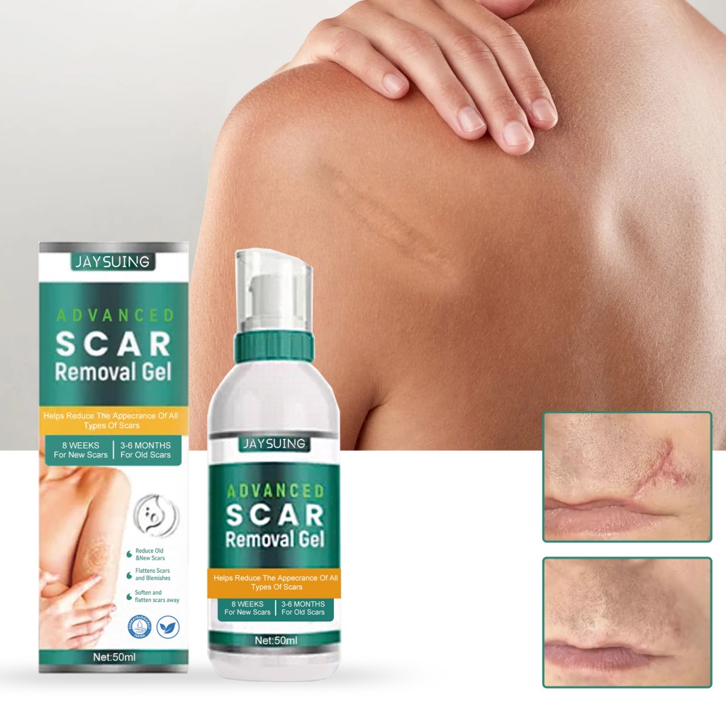 Jaysuing Fade Scar Gel Fade Pregnancy Surgery Scar Moisturizing Smooth ...