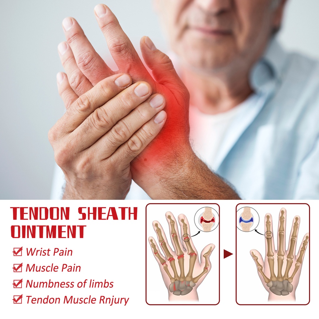 【BUY 2 GET 1 Gift】Ouhoe Tendon Sheath Care Cream 10g Ointment ...