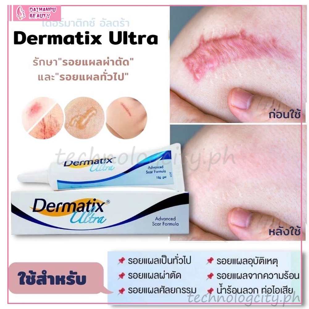 Dermatix Ultra Gel Creams to fade dark scars, keloid scars, scars 15g ...