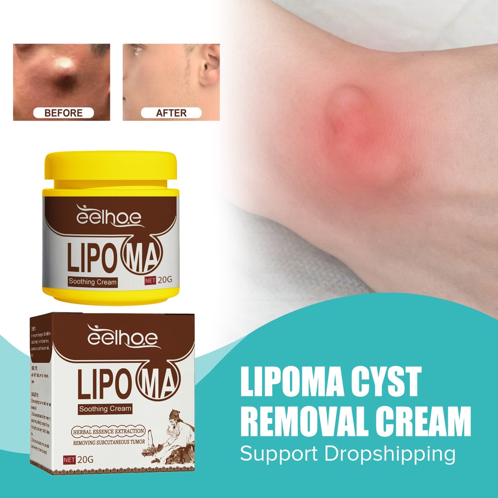 Lipolysis Removal Cream Swelling Cellulite Antitumor Treatment ...