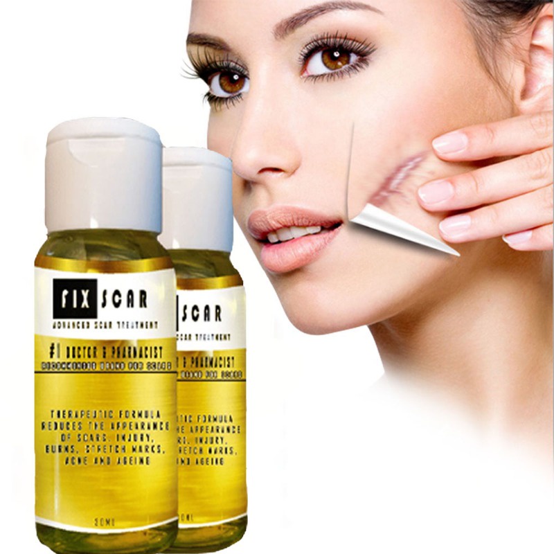 Original FixScar Removal Fix Scar Advance Gel Treatment (Para sa peklat ...
