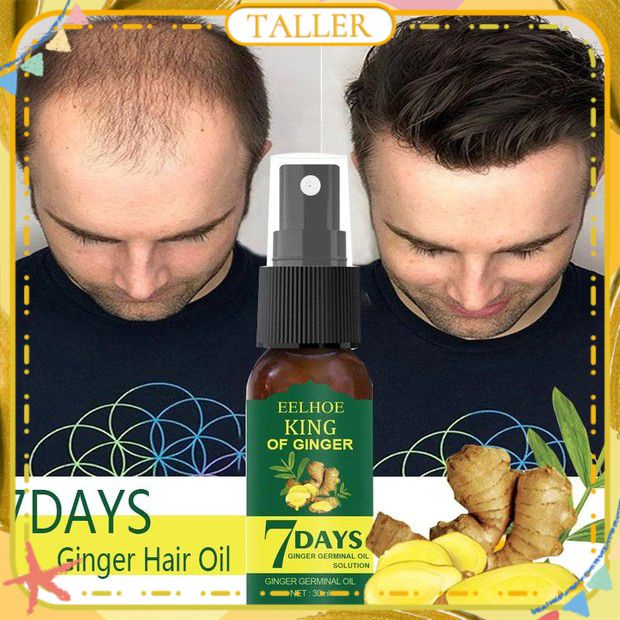 Ready Stcok Eelhoe 7 Days King Of Ginger Hair Growth Spray Hair Loss Prevention Promote Hair ...