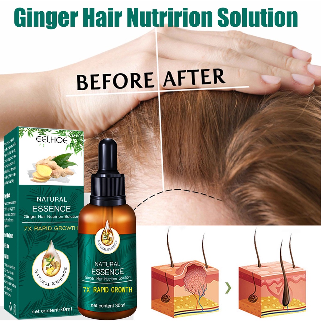 Natural Essence Ginger Hair Nutririon Solution Rapid Hair Growth Serum ...