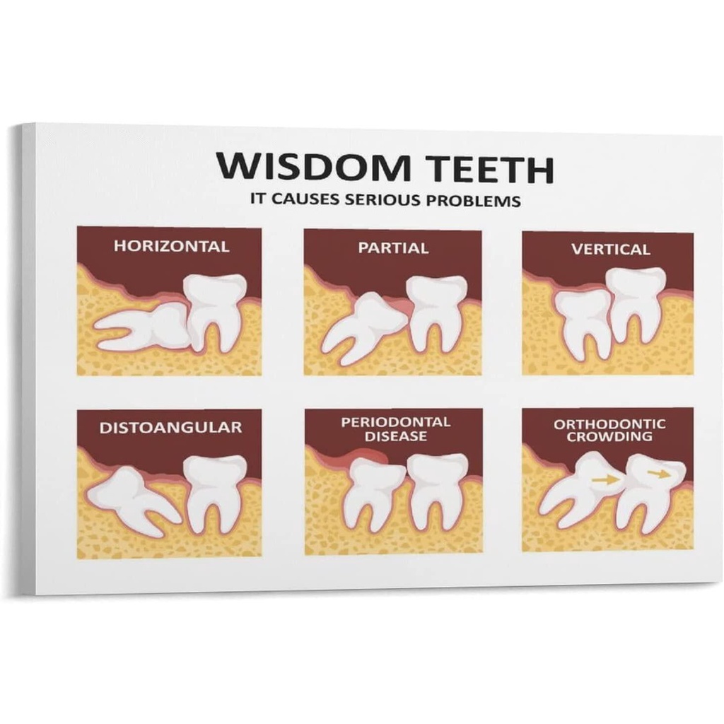 Wisdom TEETHIT Causes SERIOUS Problems School Nurse Office Decorations ...