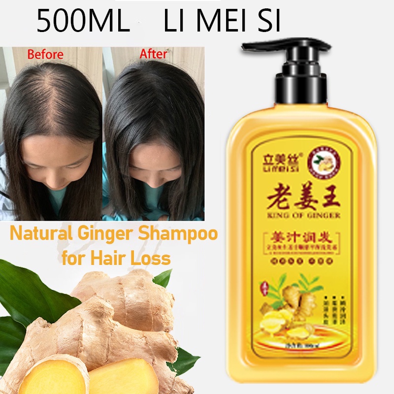 tally# king of ginger 500ml fast regrowth hair thick Anti-Hair Loss ...