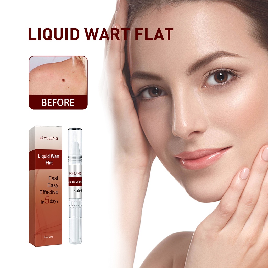 Shopkeeper's selection# Jaysuing skin label kewart Liquid Pen to remove ...