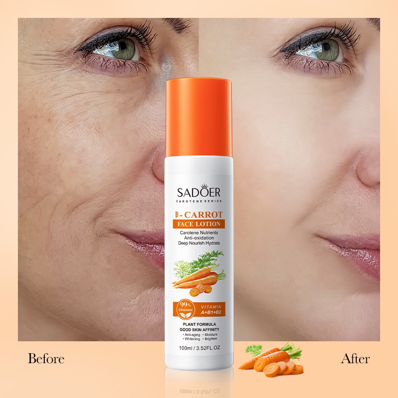 SADOER β Carrot lotion Hydrates and moisturizes the skin 100ml | Shopee ...