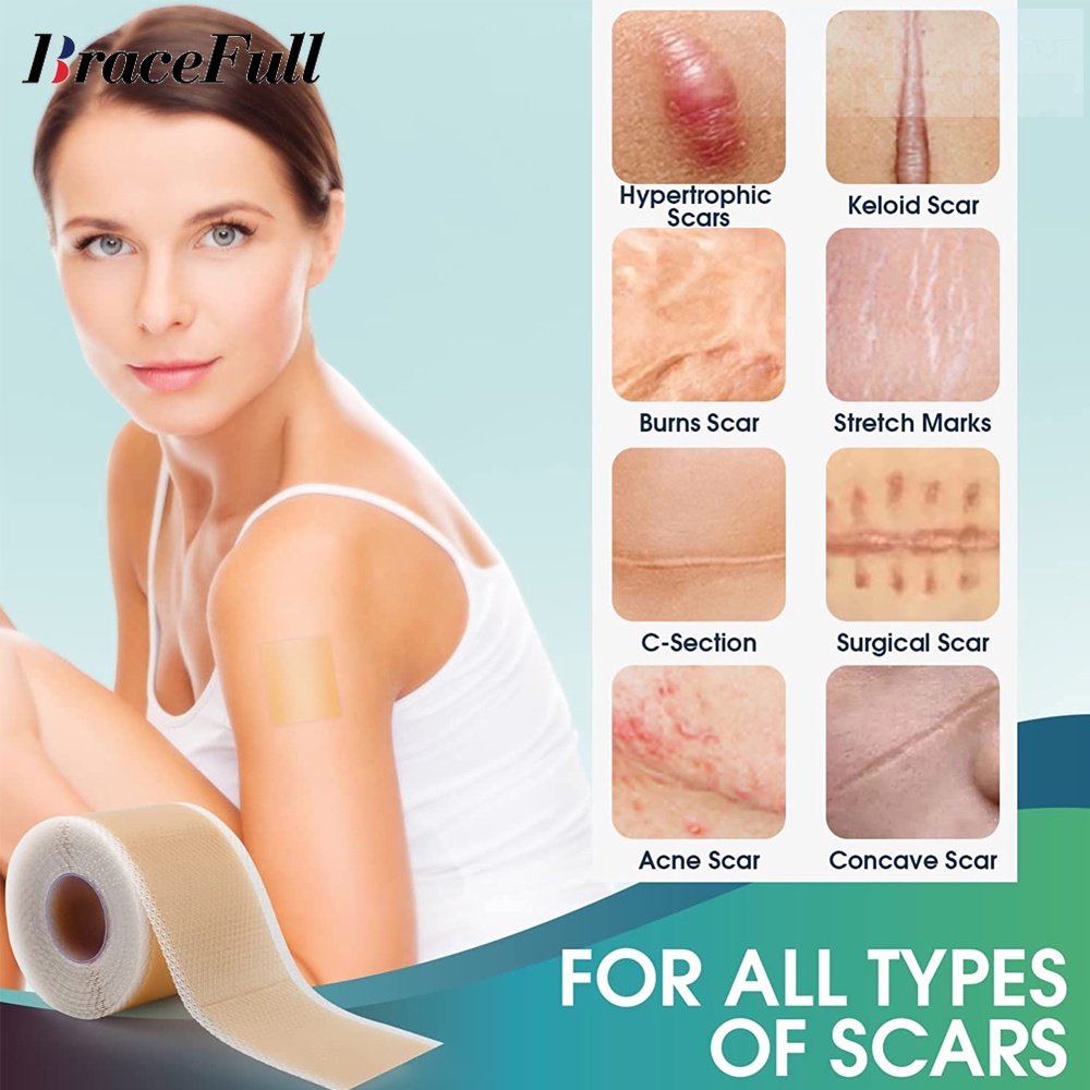 1 Roll Professional Silicone Scar Sheets Scars for C-Section, Surgery ...