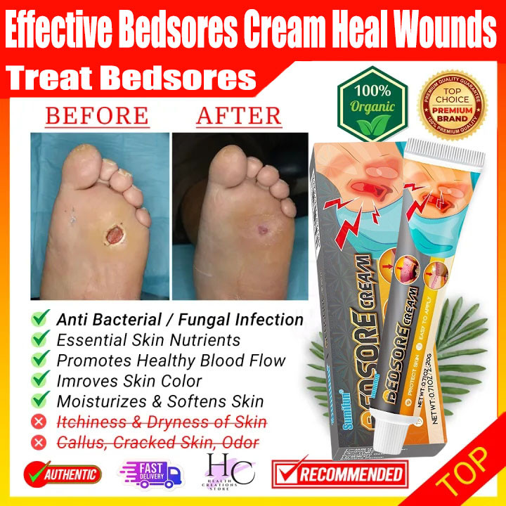 Effective Bedsores Cream Heal Wounds Pressure Ulcer Festering Rot Skin ...