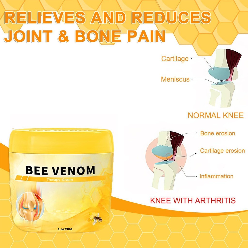 Bee venom joint care cream Relieves joint pain in hands and feet Body ...