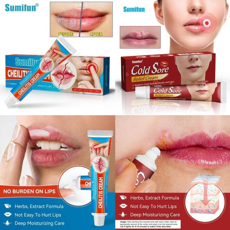 Cold Sores Treatment Herpes Antibacterial Ointment Chapped 20g Cheilitis Balm Lip Care Skin ...
