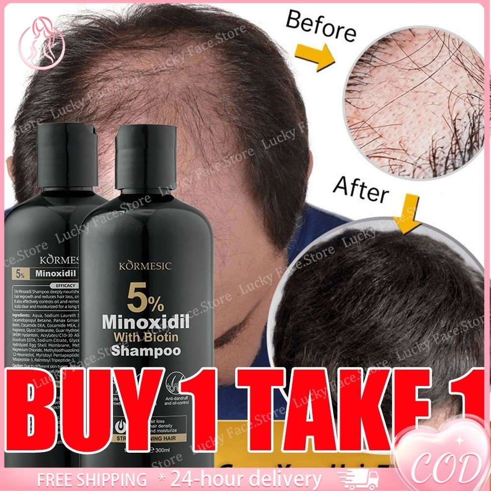 Minoxidil Hair Shampoo with Biotin Hair Grower Anti Hair Loss Anti ...