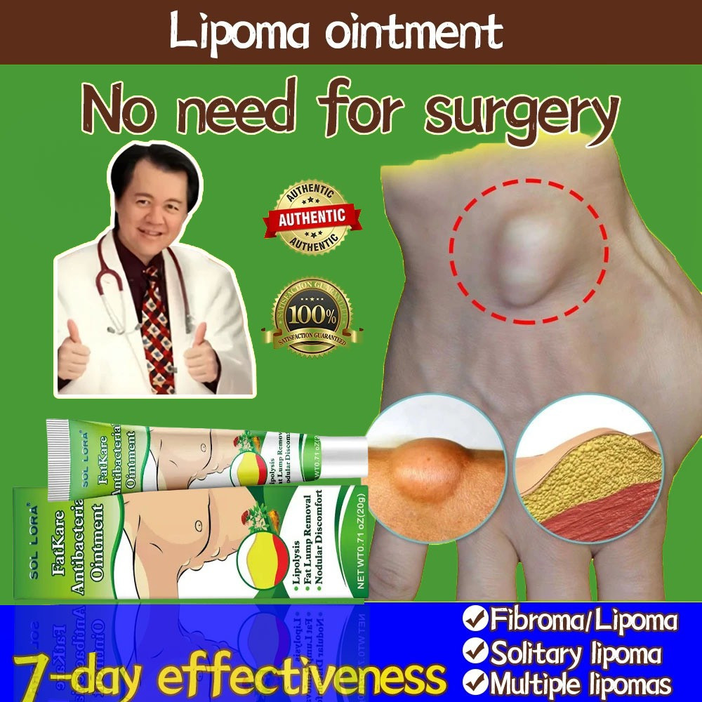 Sol Lora Fast Effect Lipoma Removal Cream 20g, Herbal Tumor Treatment ...