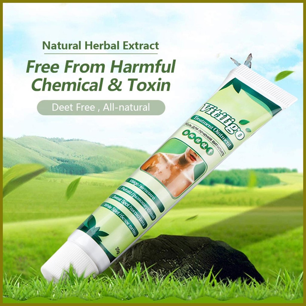 Vitiligo Care Cream External Vitiligo Treatment Improve Skin ...