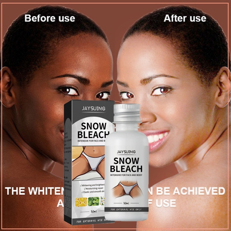 30ml Internal Thigh Whitening Cream for Armpit Corns Shiny for Armpits ...