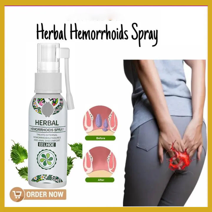 Hemorrhoid spray almoranas ointment original hemorrhoid cream ...