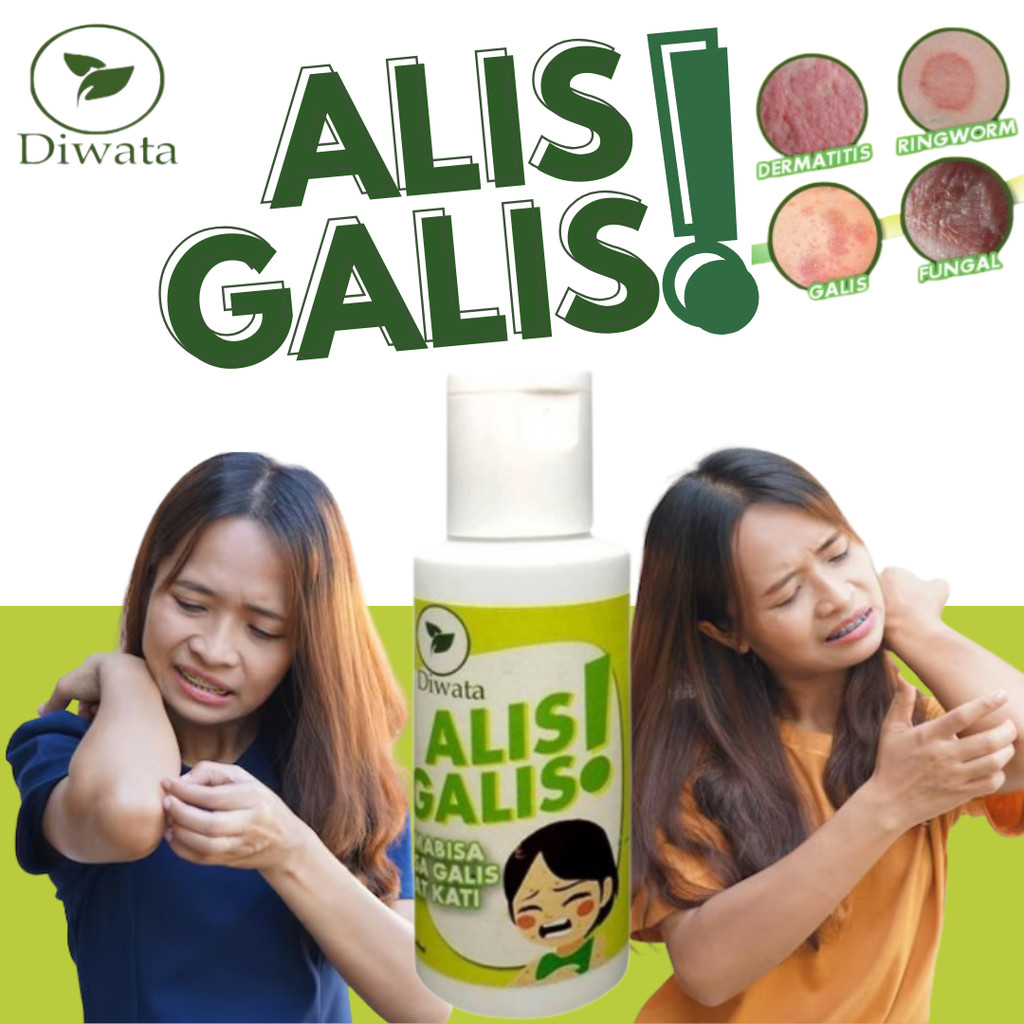 Diwata Alis Galis Ringworm Dermatitis 60ml Skin Itching Kati Kati Fungi ...