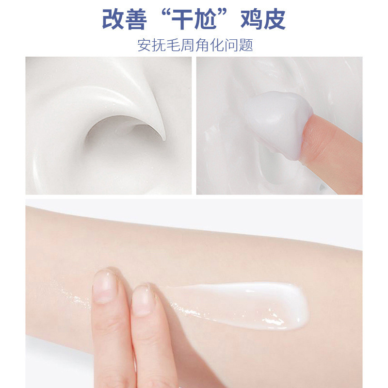 Muziyanwei E Urea Cream Improves Rough Skin Whole Body Can Use ...