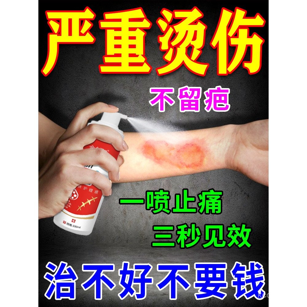 Japanese Burn Special Effect Boiling Water Hot Oil Burn Injury Repair ...
