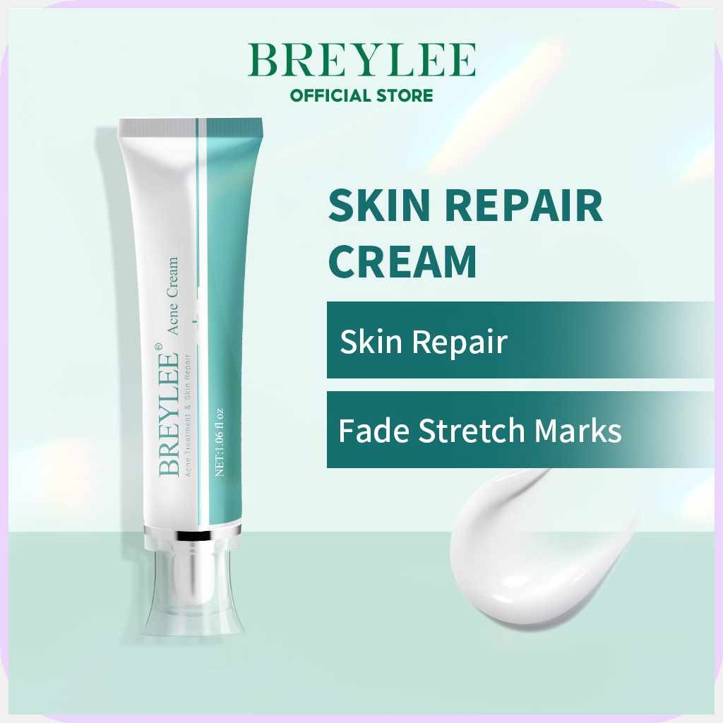 BREYLEE}cd,Scar^Z,Repair{P