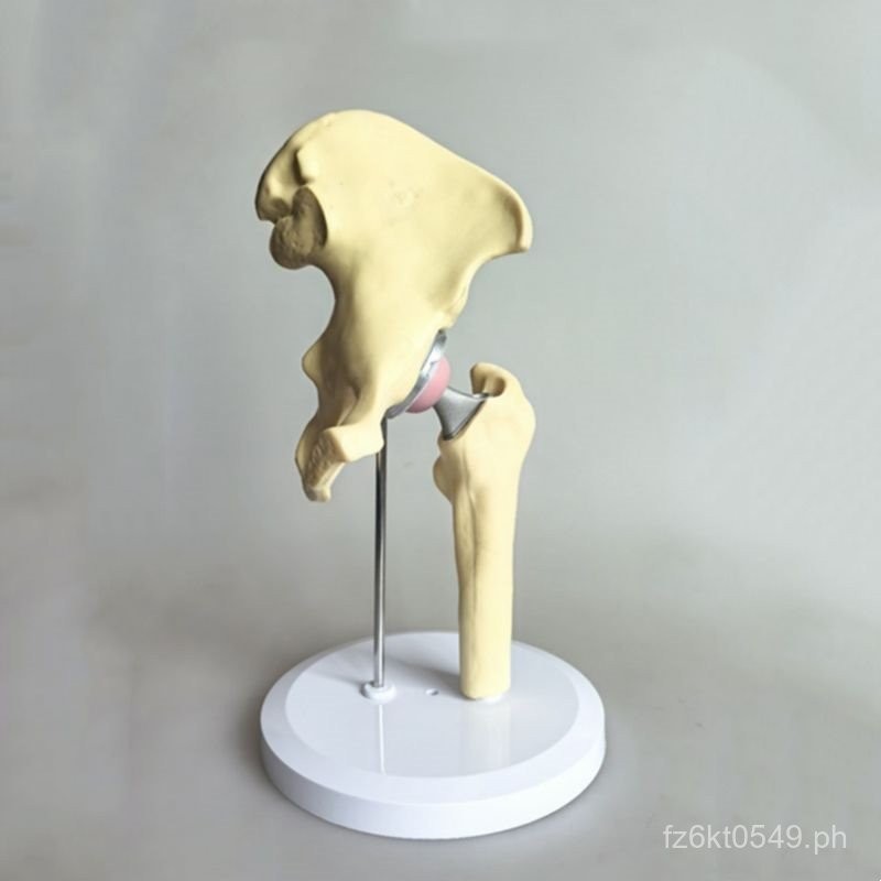 Clinical Teaching Orthopedic Femoral Head Hip Joint Preoperative ...