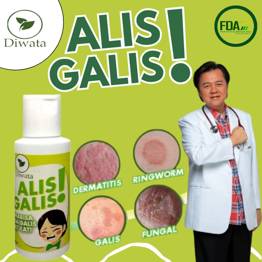 Alis Galis Dermatitis 60ml Skin Fungi Itching Fungal Diwata Kati Kati ...