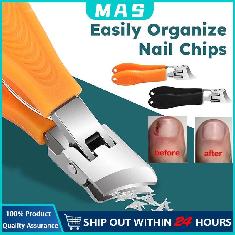MAS Toe Nail Clippers Remove Dead Skin Nail Correction Nippers Ingrown ...