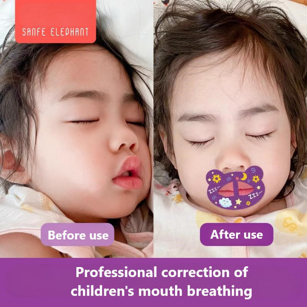 Children's mouth breathing correction patch, shut up and sleep, anti snoring device, sealing ...