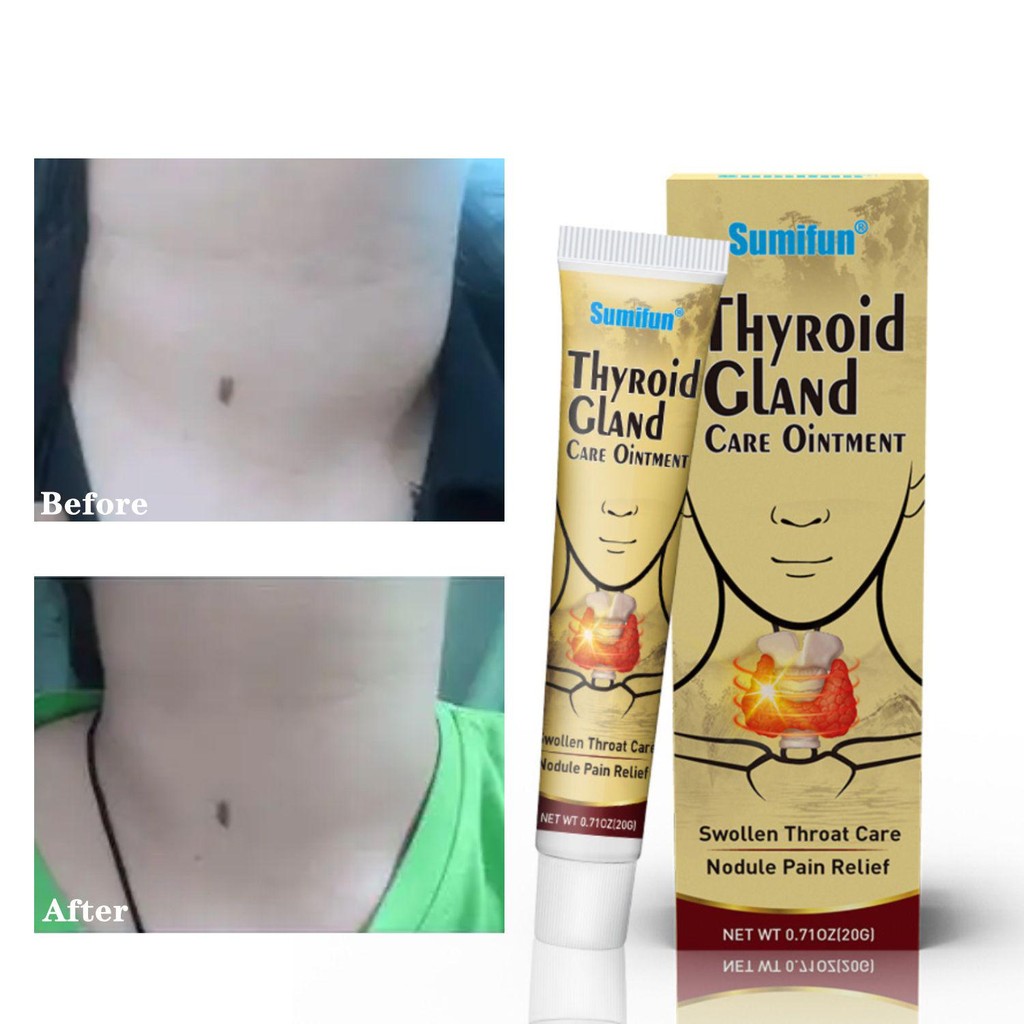 Thyroid-Thyroid cream-Thyroid Nodule Ointment 20g Thyroiditis Pain ...