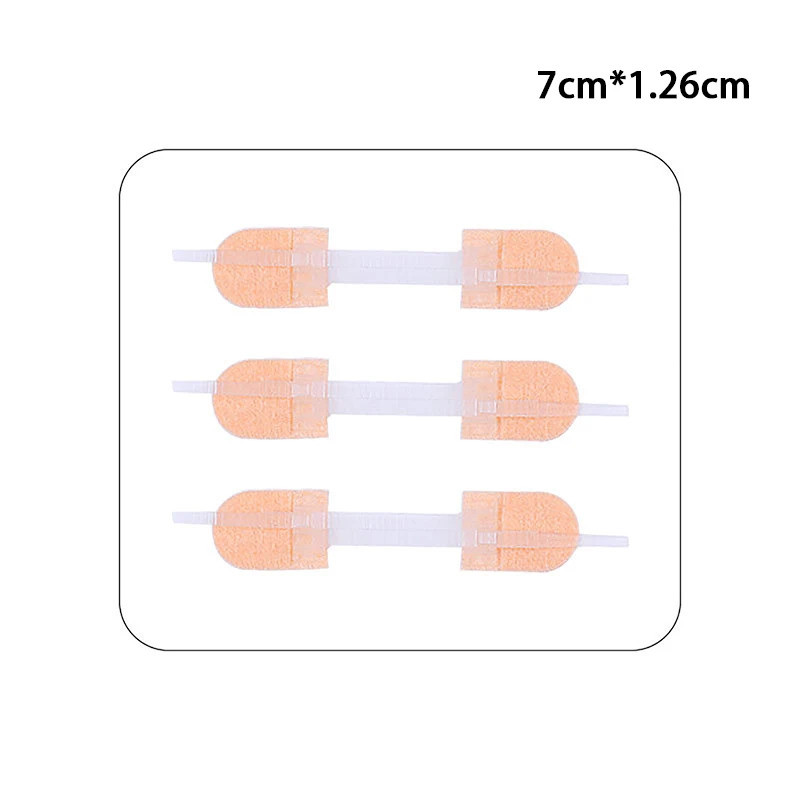 Emergency Wound Closure Zipper Patch Hemostatic Fast Suture Band for ...