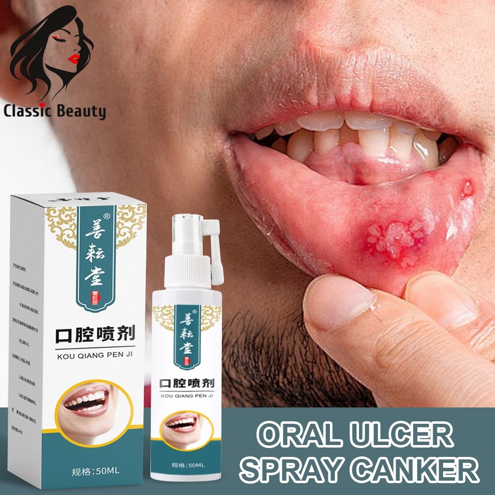 Oral Ulcer Spray Mouth Ulcer Treatment Canker Sore Spray Treatment ...
