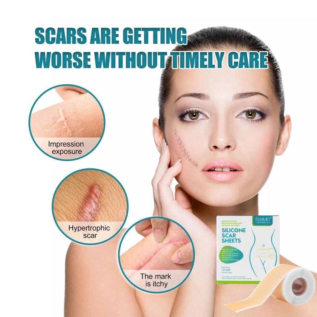 ELAIMEI Silicone Scar Patch 1 Roll Surgery Scar Removal Silicone Gel Sheet Patch Tape Sticker ...