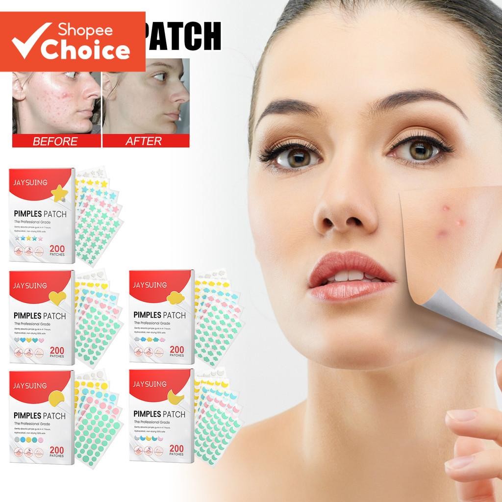 200PCS+180PCS Colorful Acne Treatment Sticker Invisible Acne Cover ...
