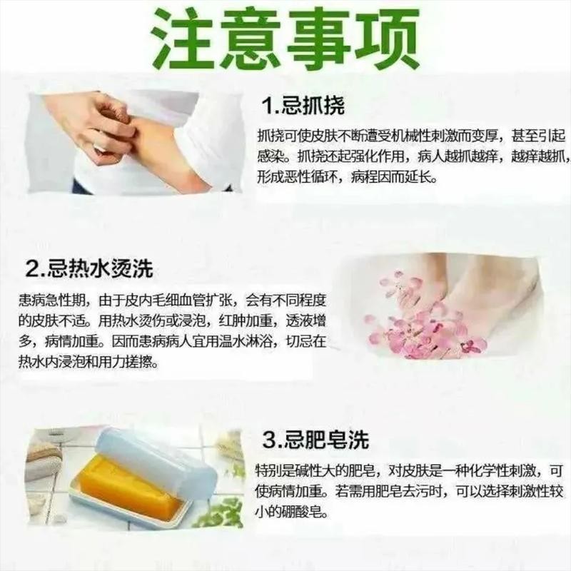 Citre cetirizine hydrochloride tablets 10mg * 12 tablets/box C ...