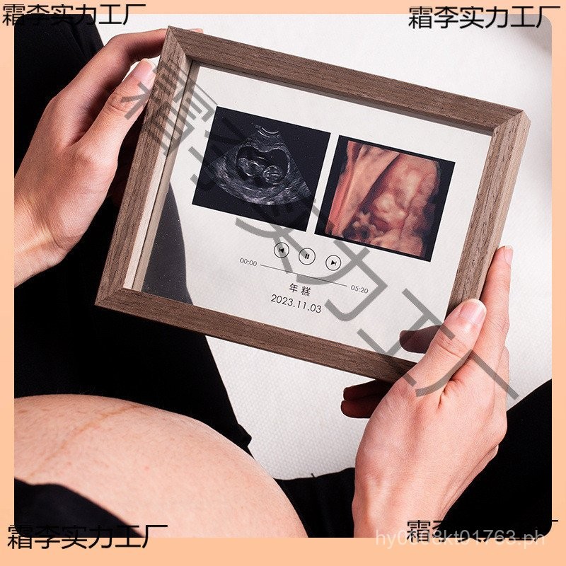 Photo Editing B Super Custom Four-Dimensional Baby Report Card Black ...