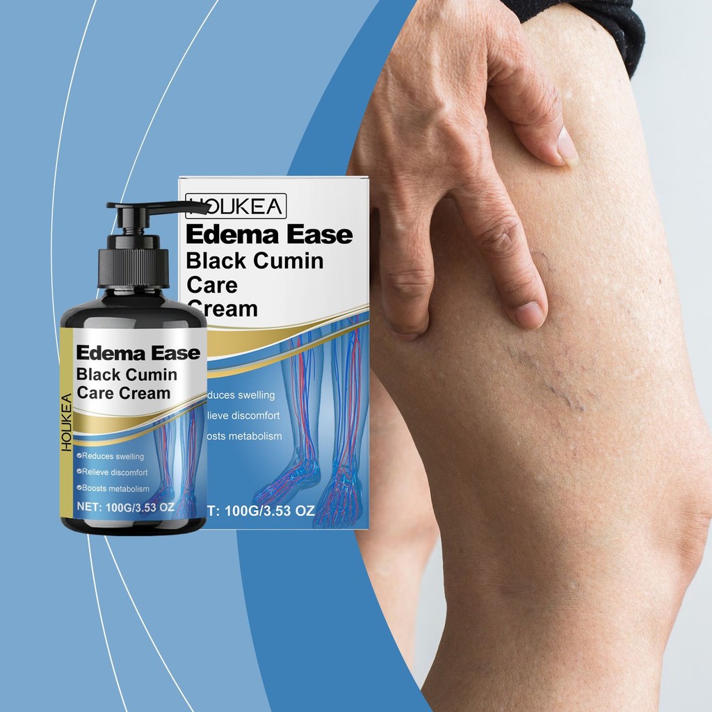 Edema Ease Black Cumin Care Cream,Herbal Body Soothing Cream | Gentle ...