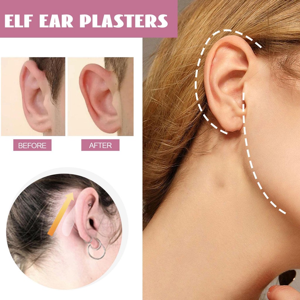 Protruding Ear Corrector Invisible Self-Adhesive Ear Tape 30PCS ...