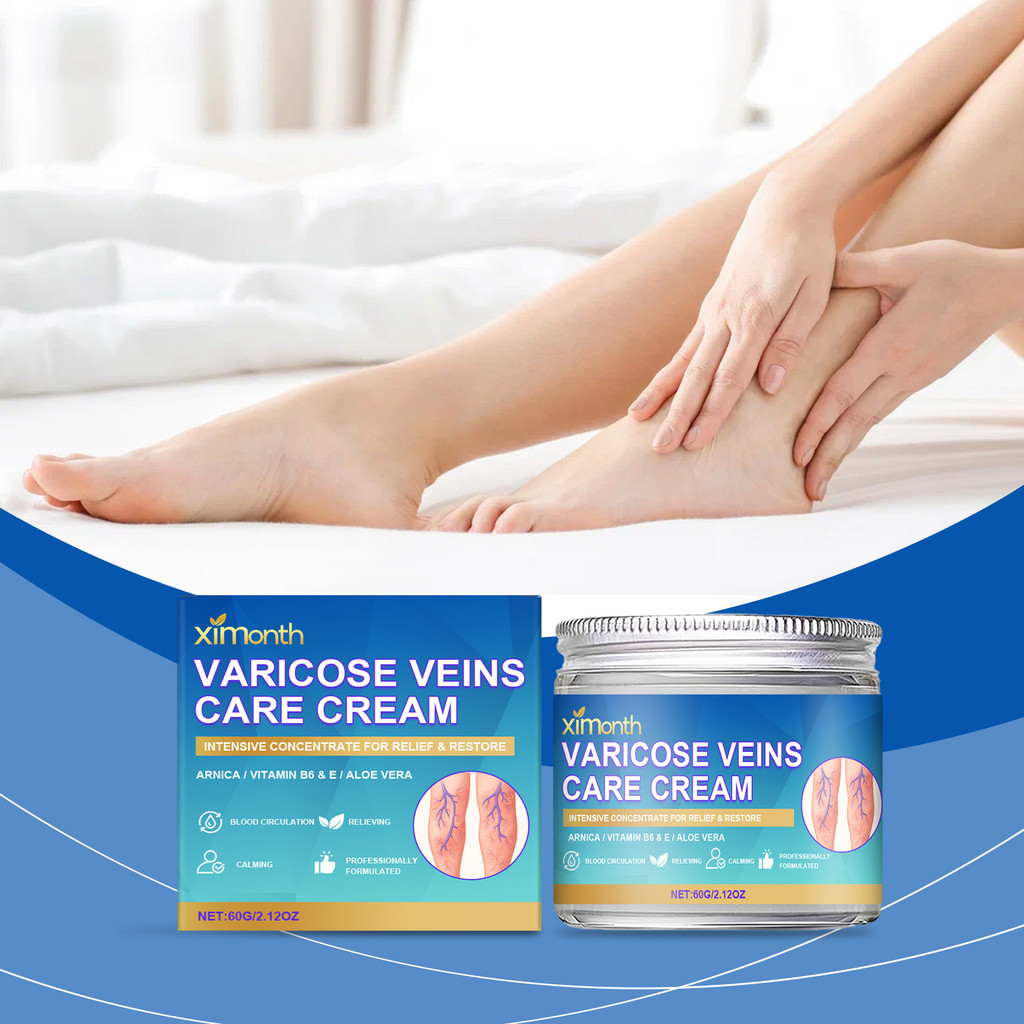 Varicose Veins Cream, Varicose Veins Treatment for Legs, Relaxing Leg ...
