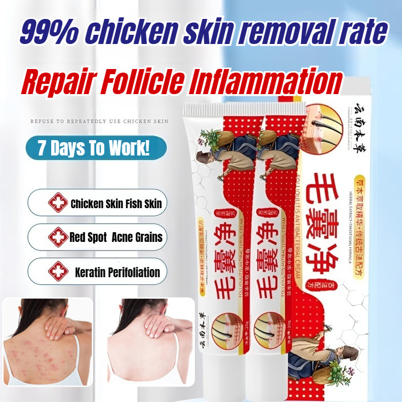 Amazing purification of hair follicles Follicle Purifying Cream ...