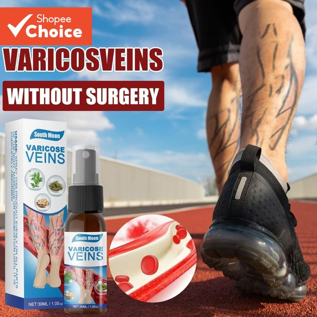 30ml Varicose Vein Spray Vena Massage Spray Smoothen Wrinkles Flatten ...