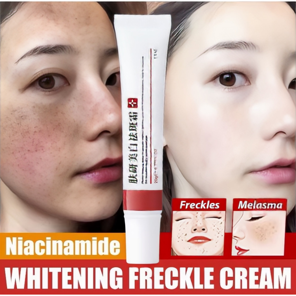 [READY STOCK]20g Whitening Freckle Cream Remove Melasma Cream Remove ...