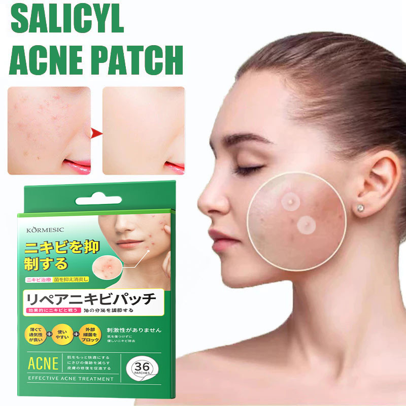 Japan Acne Pimple Patches | Acne Removal Skin Care Stickers for Face ...