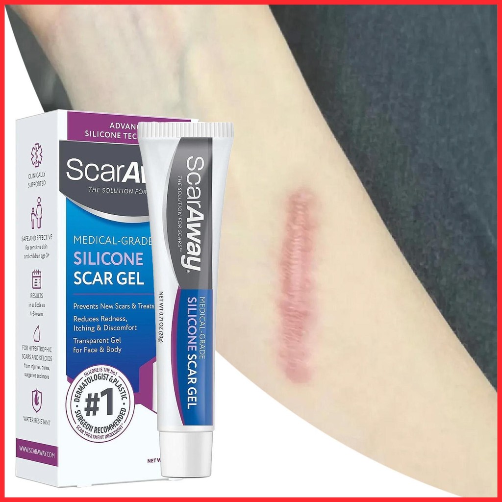 Scar Silicone Gel Keloid Bump Removal Scar Fade Solution for Postpartum ...