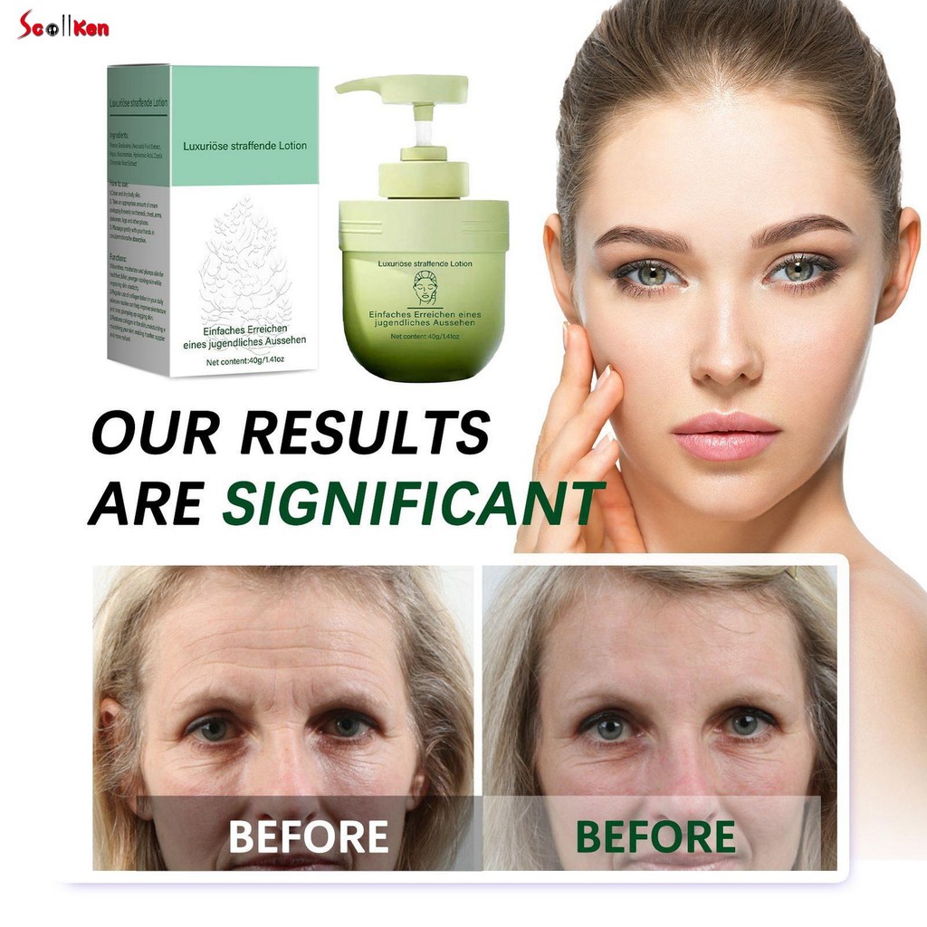 Collagen Skin Repair Lifting Cream Improve Skin Pigmentation Cream for ...