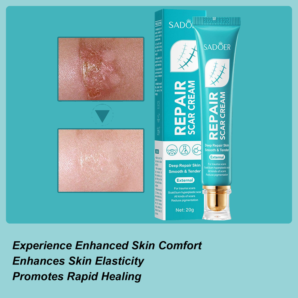 Acne Scar Removal Cream 20g Professional Scar Removal Stretch Marks ...