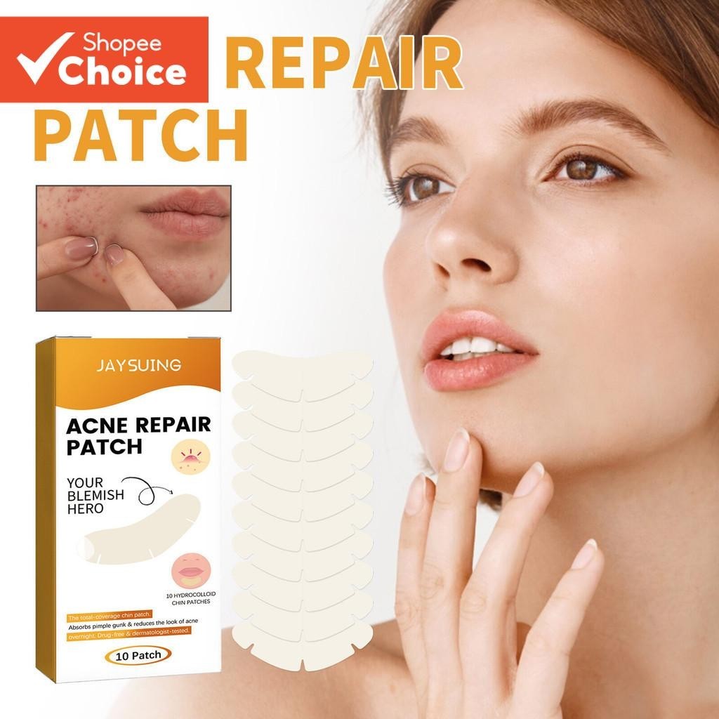 CHIBEL 10 Patches Chin Acne Patch Hydrocolloid Acne Pimple Patch ...