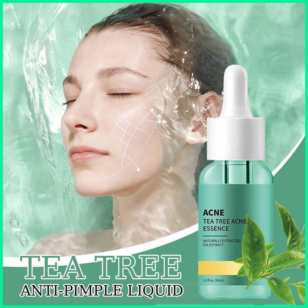 Face Moisturizing Facial Anti-Pimple Repairing Solution 30ml Skin ...