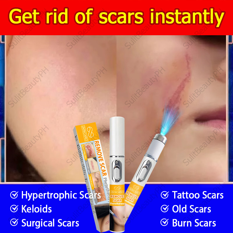【New】Scar Removal Laser Pen - For Scar hyperplasia, Qld scars，Acne ...