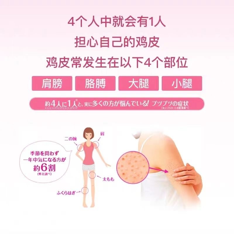 Original imported chicken skin cream exfoliation and whole b ...